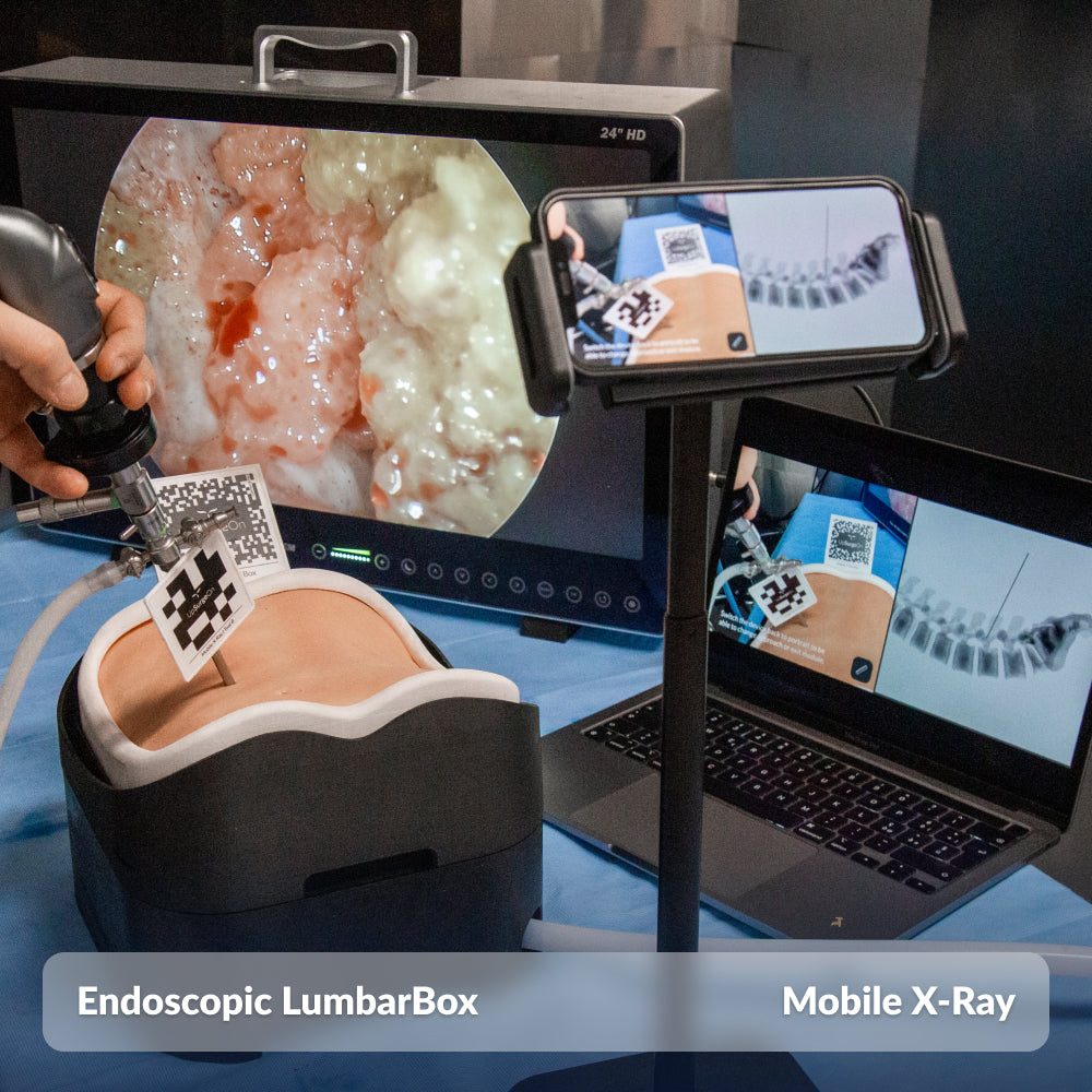 Endoscopic LumbarBox – UpSurgeOn Store